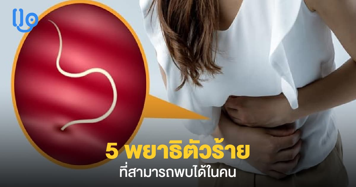 พยาธิ 5 ประเภท ที่สามารถพบได้ในคน - Hello Khunmor