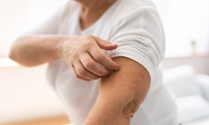 Bullous pemphigoid คือ โรคเพมฟิกอยด์ เป็นอย่างไร - Hello Khunmor