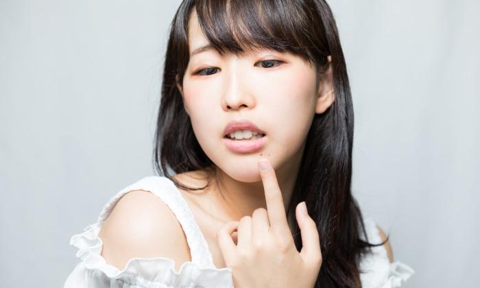 ร้อนในเกิดจาก สาเหตุอะไร รักษาได้อย่างไร - Hello Khunmor